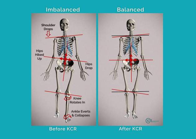 Kinetic Chain Release - KCR in Newry - Airmid Therapies ...